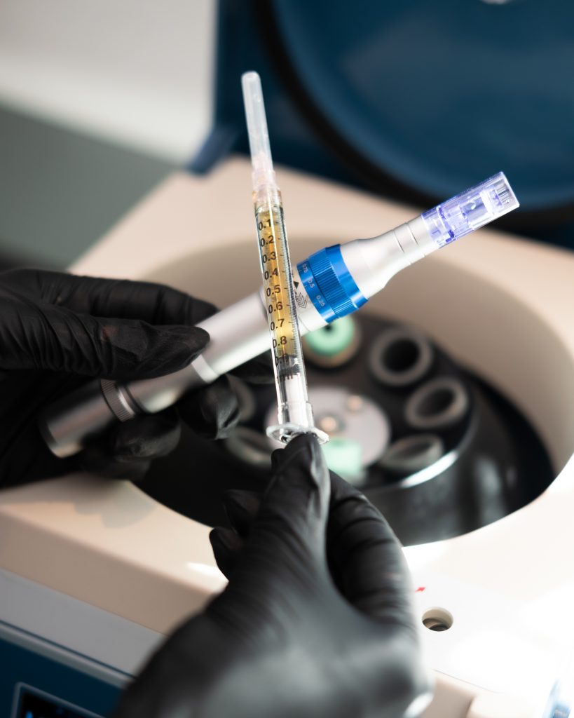 PRP for Skin Rejuvenation - L'Amour Clinic